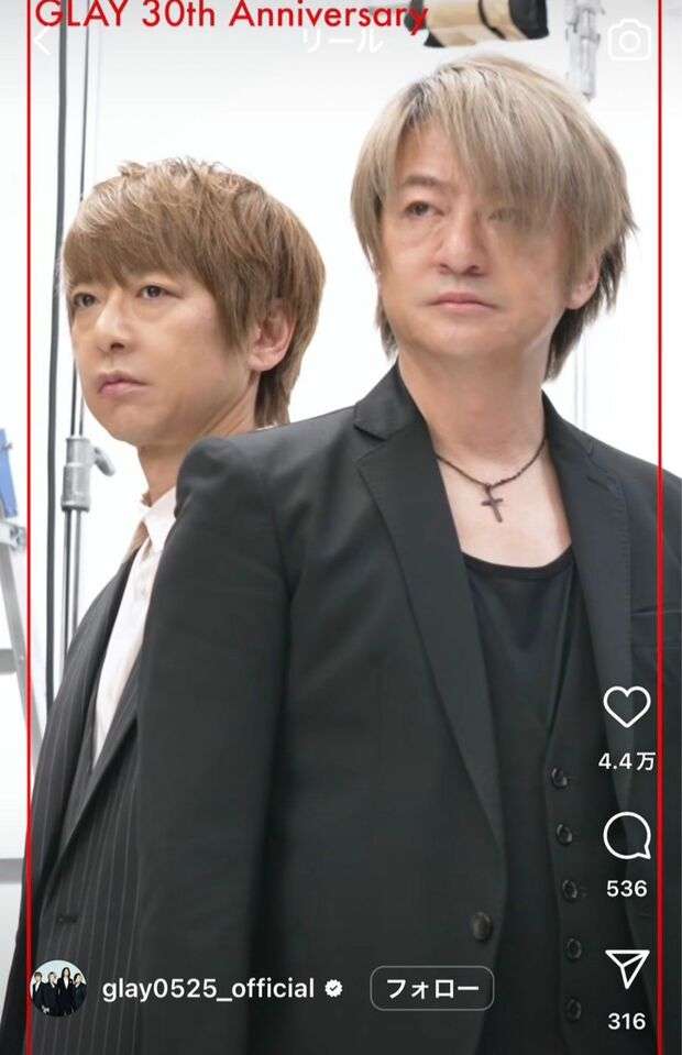 「おじいちゃんになってる」デビュー30周年を迎えるGLAYの近影に衝撃受ける人が続出した理由 | ガールズちゃんねる - Girls Channel